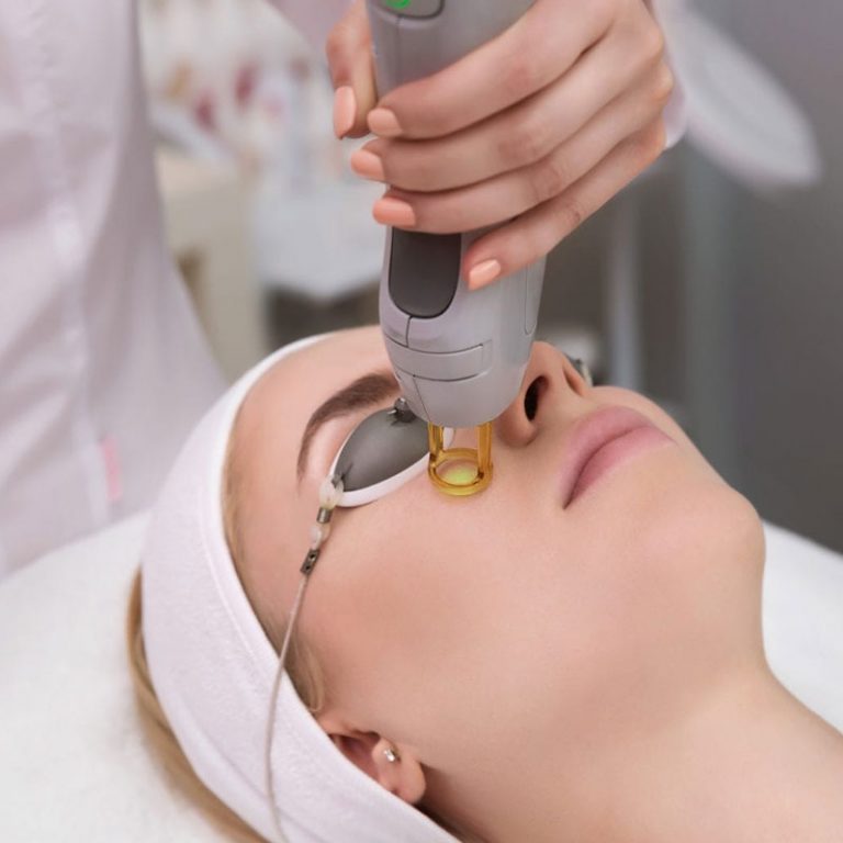 Fractional CO2 Laser Treatment In Singapore Ang Skin Hair Clinic Fractional CO2 Laser Treatment In Singapore Ang Skin Hair Clinic